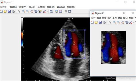 Matlab手动选取roi区域（自己写的一个小函数）matlab在图像上选取roi Csdn博客