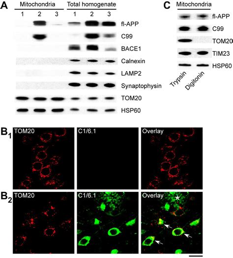 Figure 1 From Mitochondrial Dysfunction And Accumulation Of The β Secretase Cleaved C Terminal