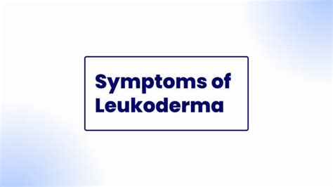 Symptoms Of Leukoderma Pdf