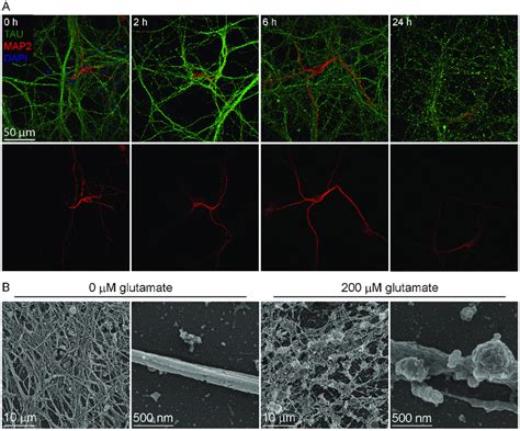 Effects Of Glutamate Treatment On Neuron Morphology A Time Course Download Scientific Diagram