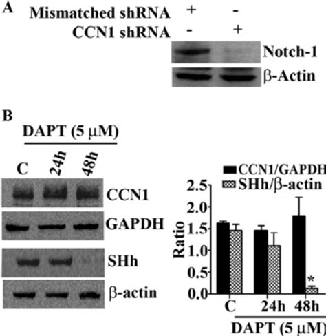 Sp Of Panc 1 Cell Line Exhibits Higher Tumor Growth Potential Along