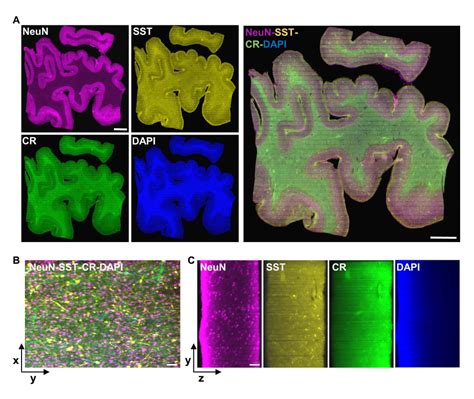 Optical Clearing And Labeling For Light Sheet Fluorescence Microscopy