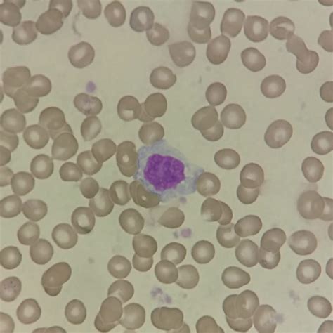 Monocytes Identification And Differentiation
