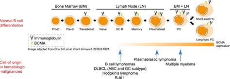 B Cell Maturation Antigen Expression Across Hematologic Cancers A
