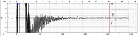 Echometer Fluid Level Surveys How They Work Downhole Diagnostic