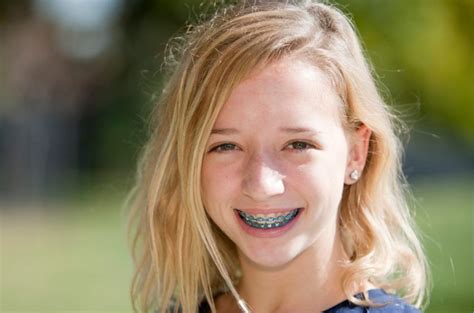 Why Diy Braces Are Dangerous Golden Hammonds