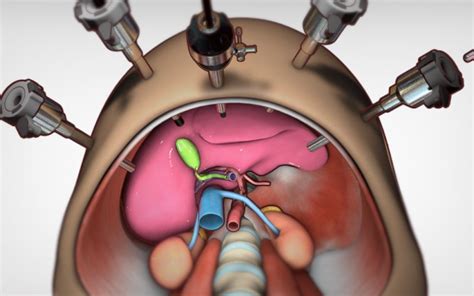 Liver Tvasurg The Toronto Video Atlas Of Surgery
