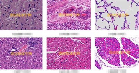 He染色原理和意义【病理技术经验】