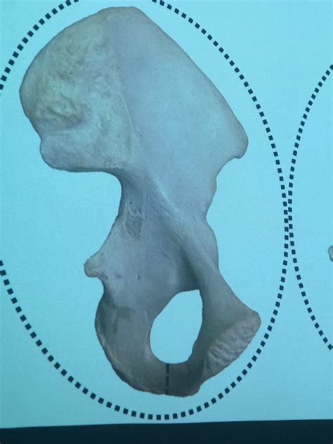 Appendicular Skeleton Flashcards Memorang Appendicular Skeleton Flashcards Memorang