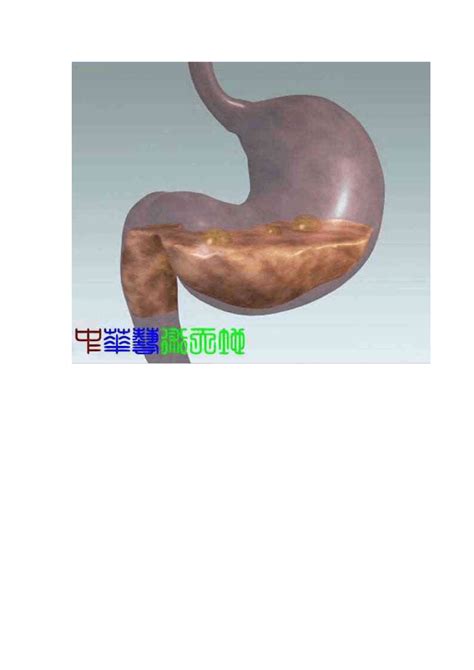 最全人体内脏结构图医学图谱 医学考试资料 Word文档在线阅读与下载无忧文档