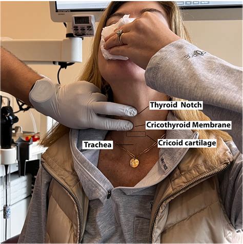 Office Based Steroid Injections For Subglottic Stenosis Operative