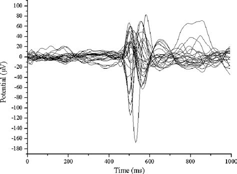 Figure 17 From Anatomically Constrained Dipole Adjustment Anaconda