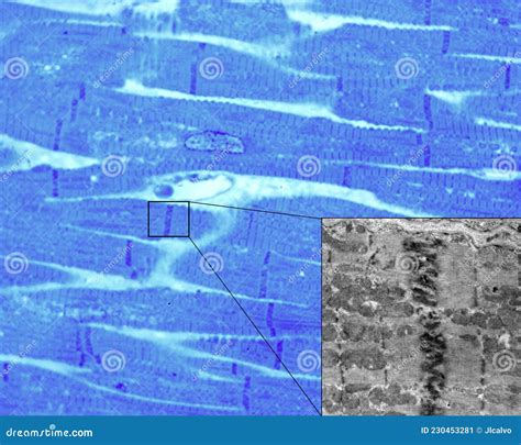 Heart Myocardium Intercalated Discs Stock Image Image Of Inset Discs 230453281