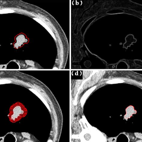 Illustration Of The Partial Volume Correction Process A Original Scan