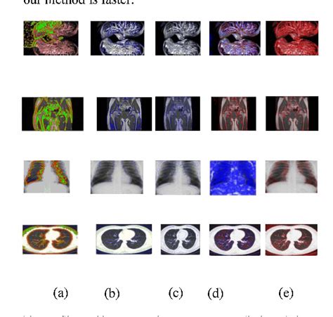 Table 1 From Modified Region Based Segmentation Of Medical Images