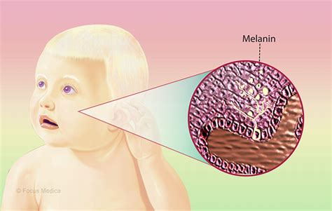Health Condition Symptoms Causes Treatment And More