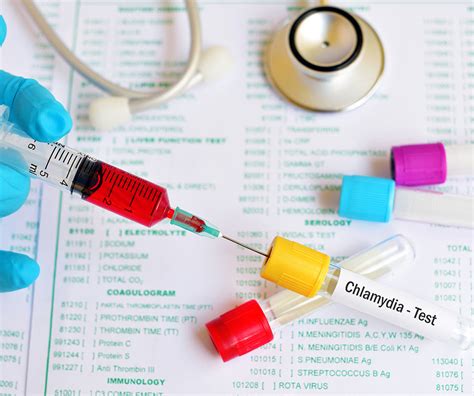 Same Day Chlamydia Test London Chlamydia Testing From £91