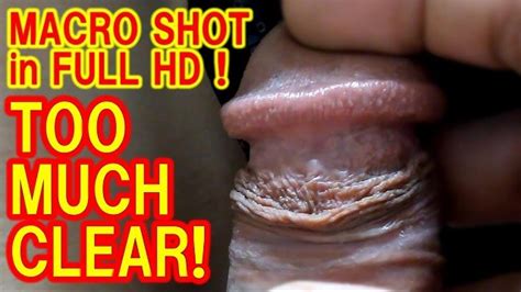 Clearly See The Wrinkles On The Foreskin And The Bumps Of The Corona On The Glans Of My Penis