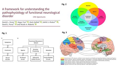 Better Understanding Functional Neurological Disorder And How Therapy Can Help Aevum Health