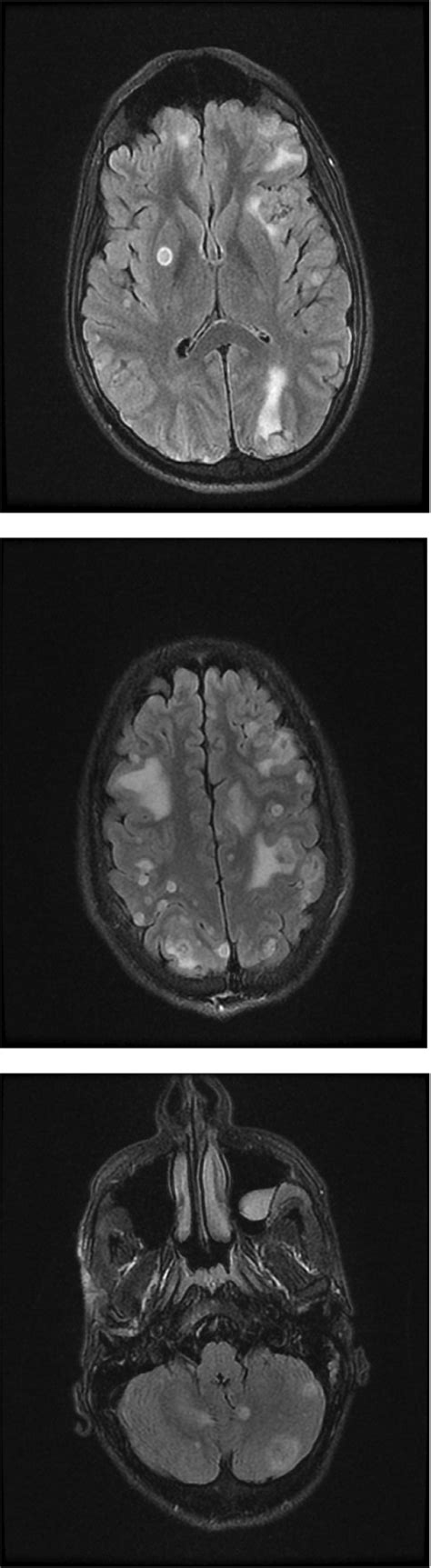 Patients Brain Magnetic Resonance Image Download Scientific Diagram