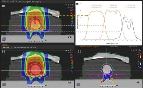 Validation Of The Raystation Monte Carlo Dose Calculation Algorithm Using A Realistic Lung