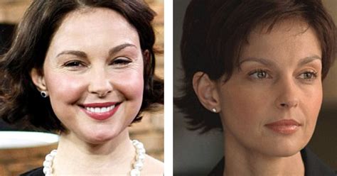 애슐리 주드 성형 의혹 얼굴에 무슨 짓을