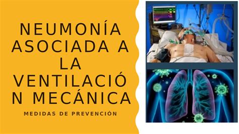 Neumonía Asociada A La Ventilación Mecánica Diapositivas De Medicina