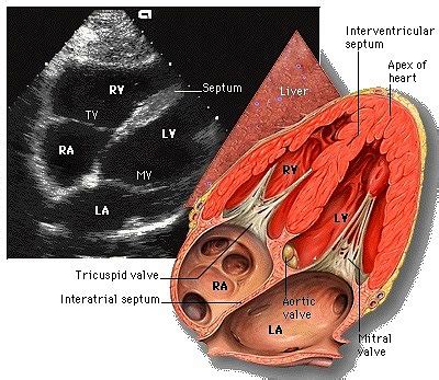 Interventricular Septum Anatomy