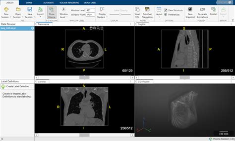 segment ct scan using monai label matlab and simulink