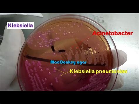 Klebsiella Pneumoniae Macconkey Agar