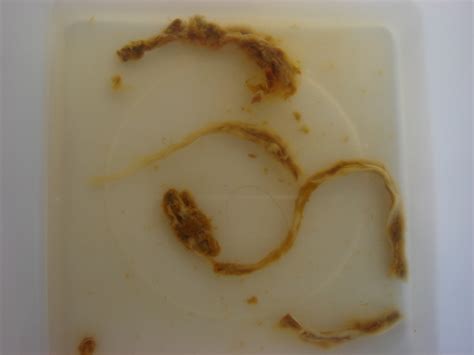 Cleanse Body Worms At Louis Brannan Blog