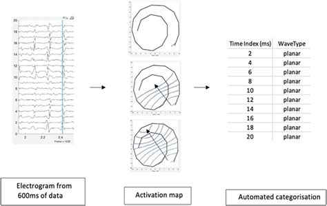 Retro‐mapping A Novel Algorithm Automating Wavefront Categorization