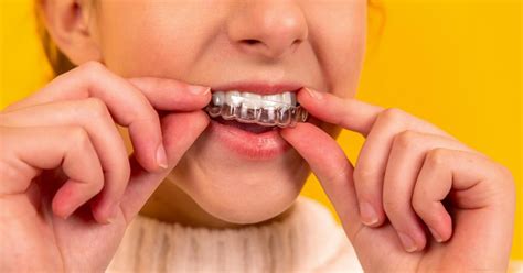 Splint For Tmj Treating Tmd And Reducing Symptoms