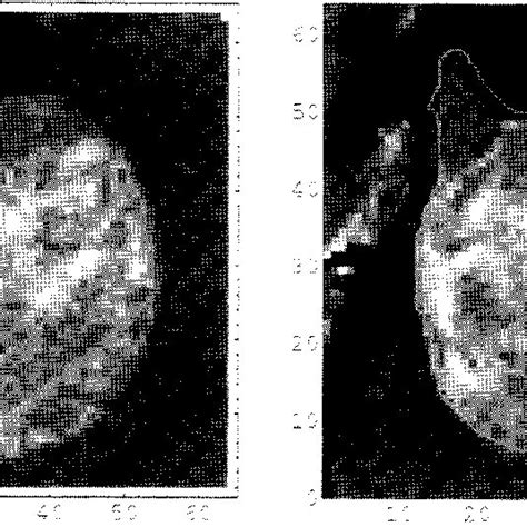 Pdf Geodesic Active Contours