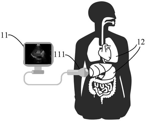 Elastic Imaging Method And Device Electronic Equipment And Storage
