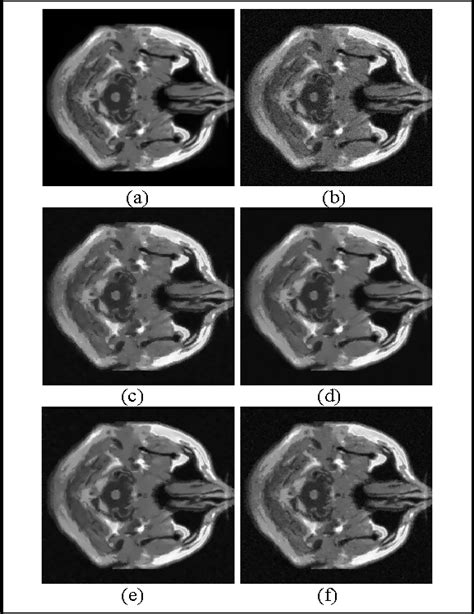 Figure 1 From Mri Denoising Using Pixel Selection Based Non Local Means