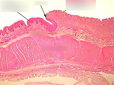 Esophagus Stomach 1 Diagram Quizlet