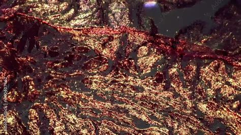 Stockvideon Contrast Microscopic Slide With Cervix Tissue Sample Magnified In 100 Times Filmed