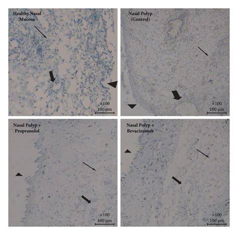 Vegf A Expressions On Each Group A Slight Expression Is Observed In Download Scientific