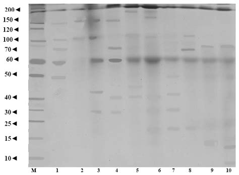 The Analysis Of Proteins Polypeptides Of Hemolymph Of Different Spider