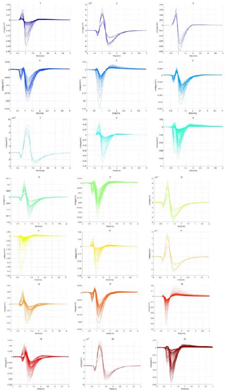 Figure 1 From Classification Of Theoretical Extracellular Action Potentials Based On
