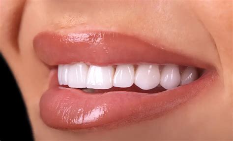 What Is A Perfect Tooth Understanding The Characteristics Of An Ideal Tooth