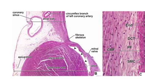 Endocardium Histology