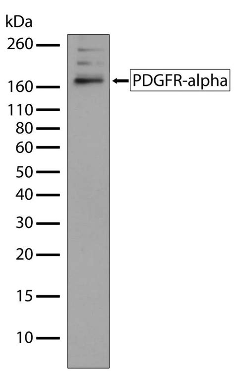 Anti Pdgfr Alpha Antibody [rp23040031] Ab313400 Abcam