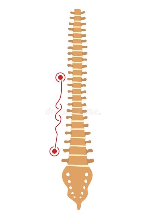 Spinal Deformity Symbol Of Spine Curvatures Or Unhealthy Backbones Human Spine Anatomy Curved
