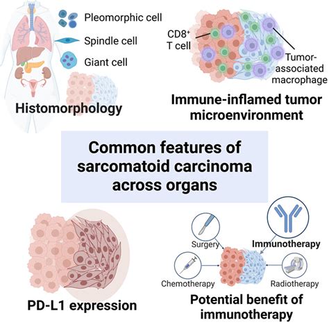 Common Clinicopathological And Immunological Features Of Sarcomatoid