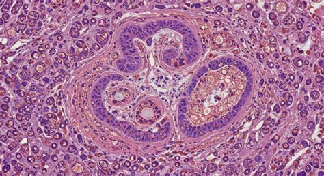 Microscopic View Of Human Lymph Node Structure Illustrative Micrograph Showcasing The Cortex