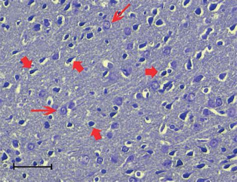 Nissl Staining Of Rats Prefrontal Cortex Following Transient Global Download Scientific