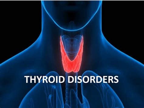 Thyroid Disease Explained By Dr Sunny Singhal Pptx