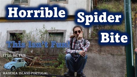 Spider Bite Or Shingles Madeira Portugal Itllbefun Youtube